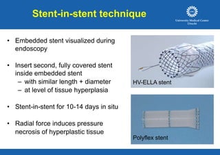 Endoscopy in Gastrointestinal Oncology - Slide 8 - P.D. Siersema ...