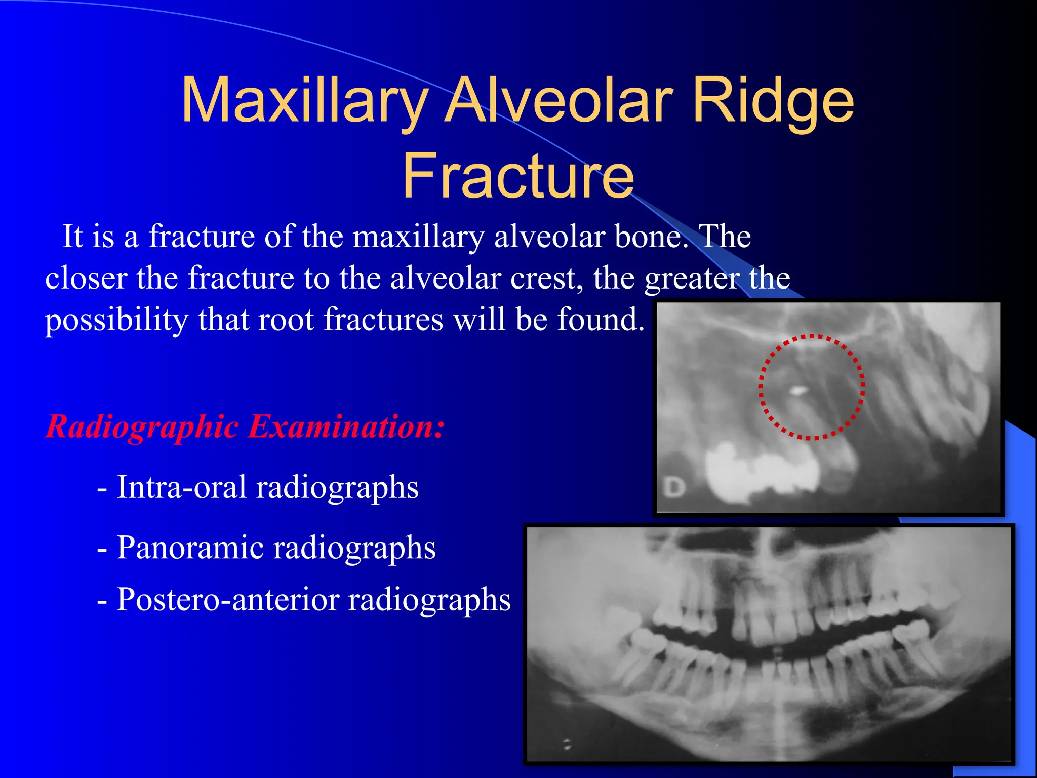 -Trauma to Teeth and Facial Structures.pptx