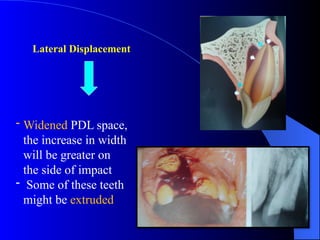 -Trauma to Teeth and Facial Structures.pptx
