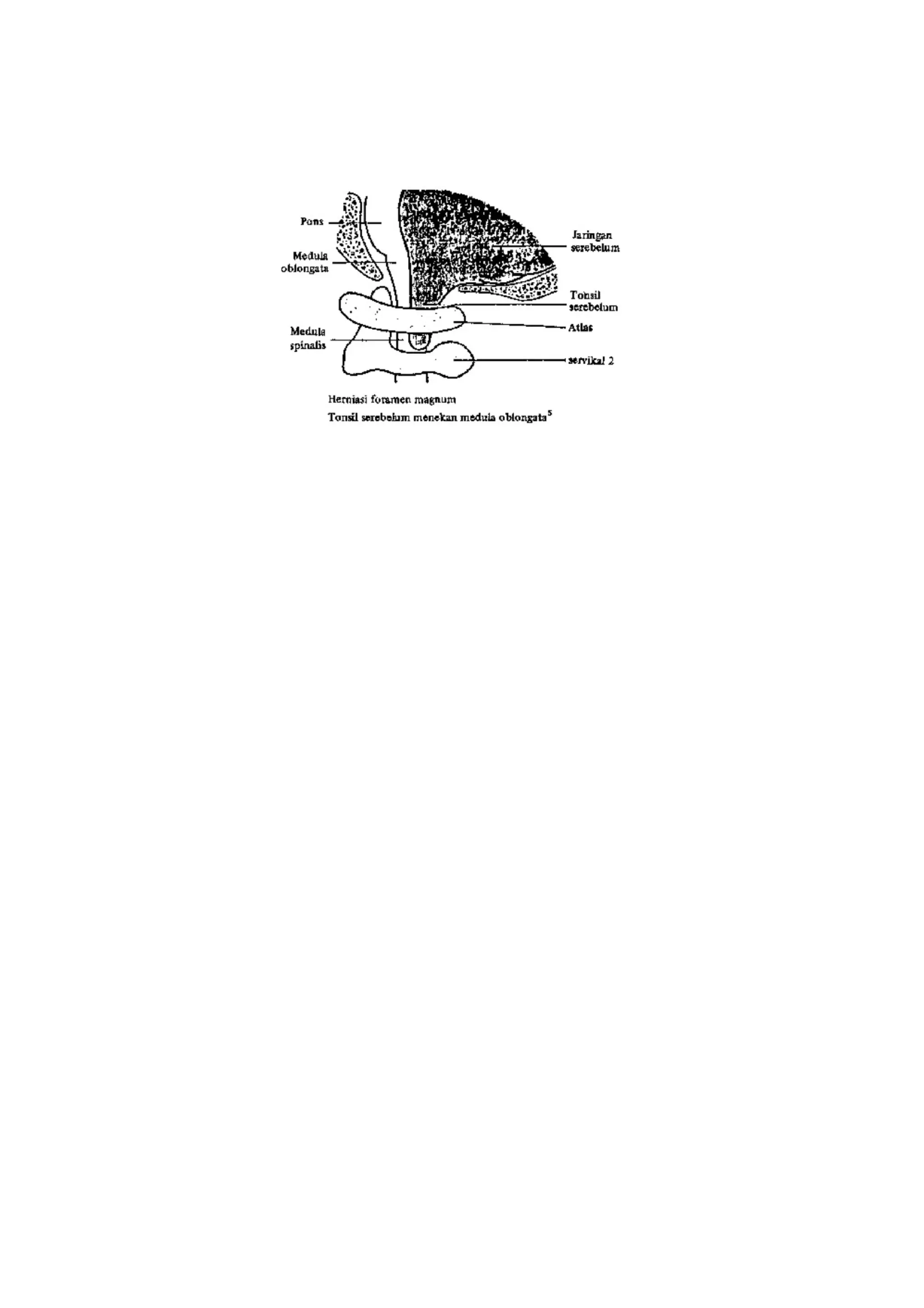 80051025 edema-serebri | PDF