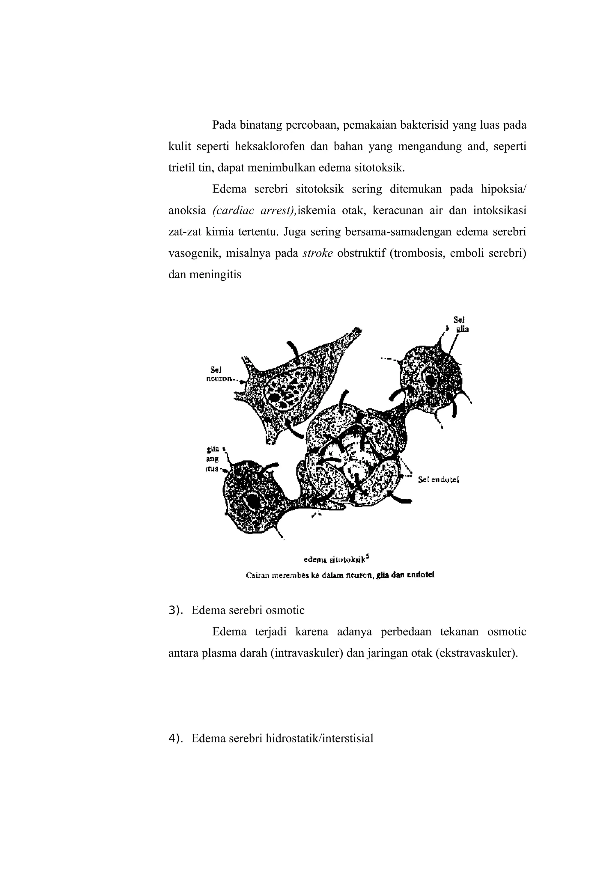 80051025 edema-serebri | PDF