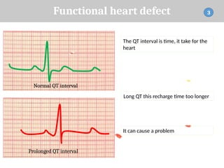 Whole exome sequencing in a family of long QT syndrome | PPTX