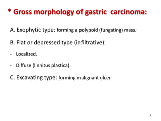 Cancers of the Stomach - Diagnosis & Management | PPT