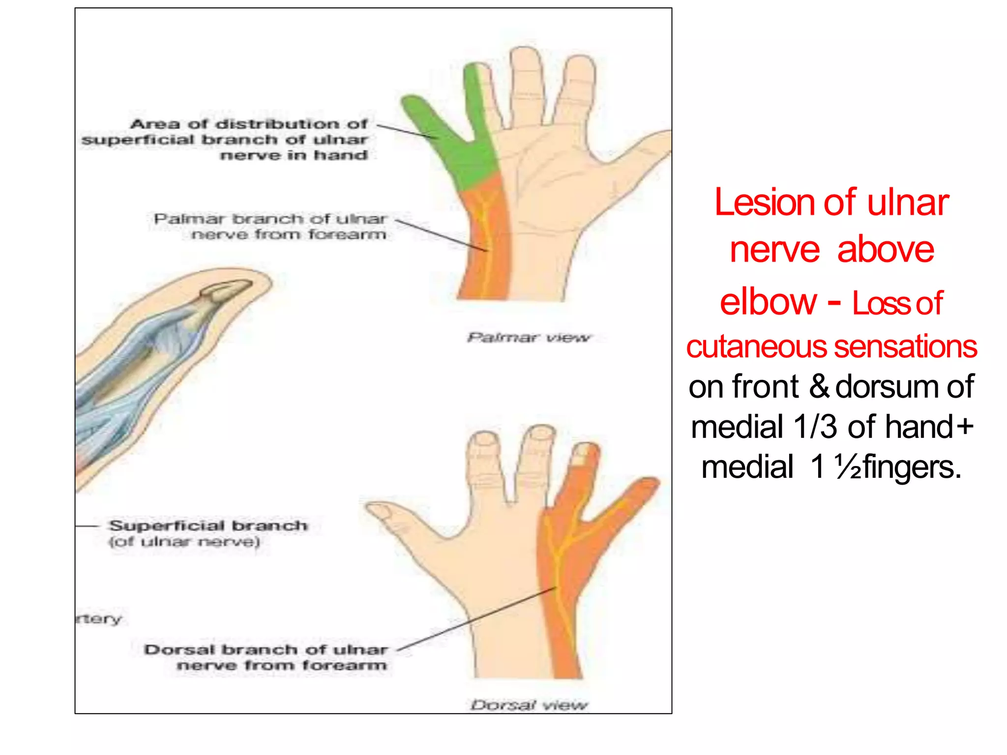 807_Ulnar-nerve-and-its-lesions.pptx