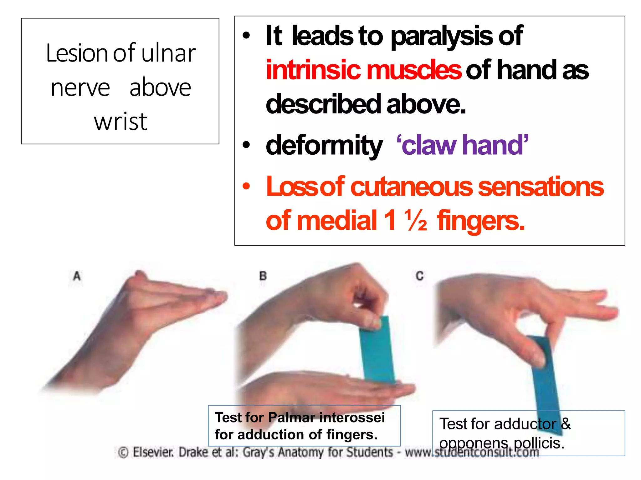 807_Ulnar-nerve-and-its-lesions.pptx