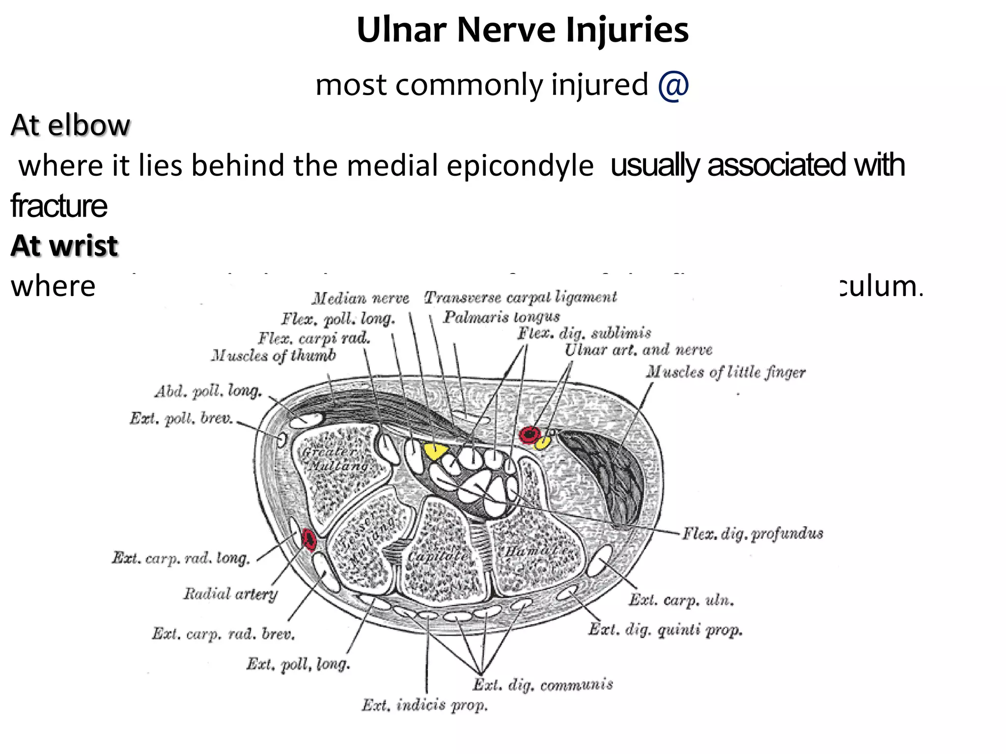 807_Ulnar-nerve-and-its-lesions.pptx