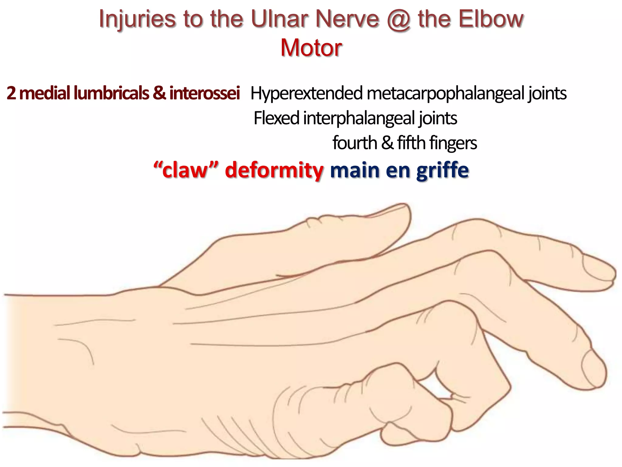 807_Ulnar-nerve-and-its-lesions.pptx