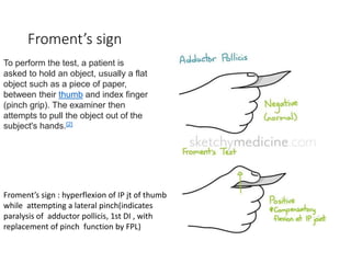 Froment Sign