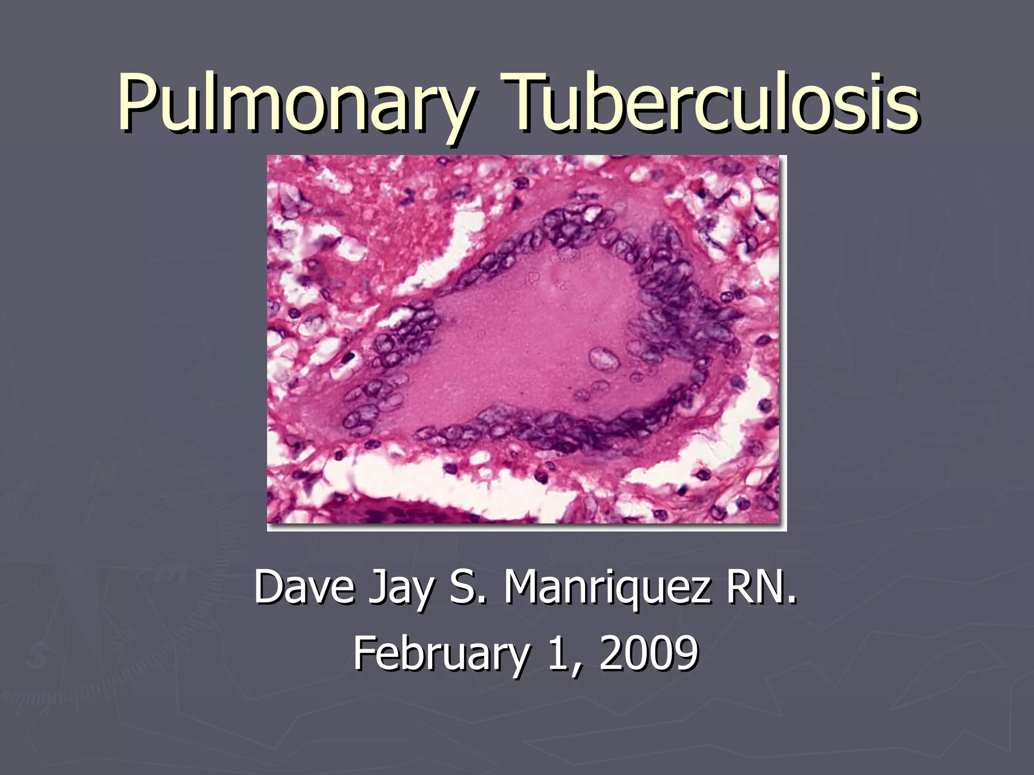 Pulmonary Tuberculosis | PPT