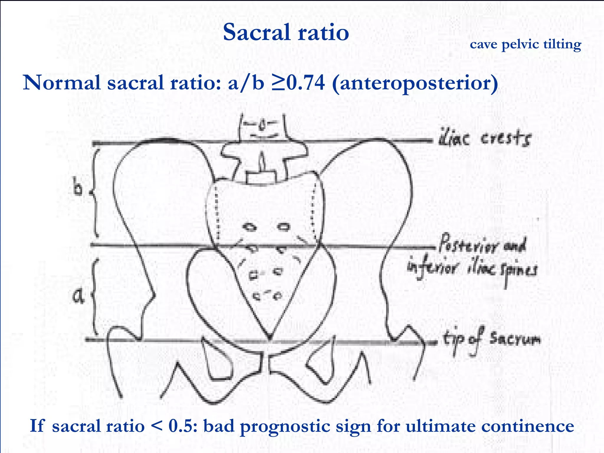 anorectal malformation | PDF