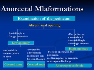 anorectal malformation | PPT