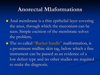 anorectal malformation | PPT