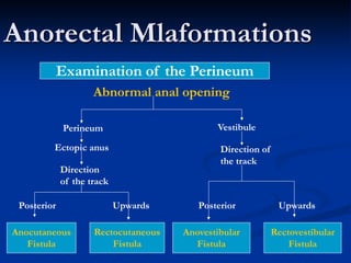 anorectal malformation | PPT