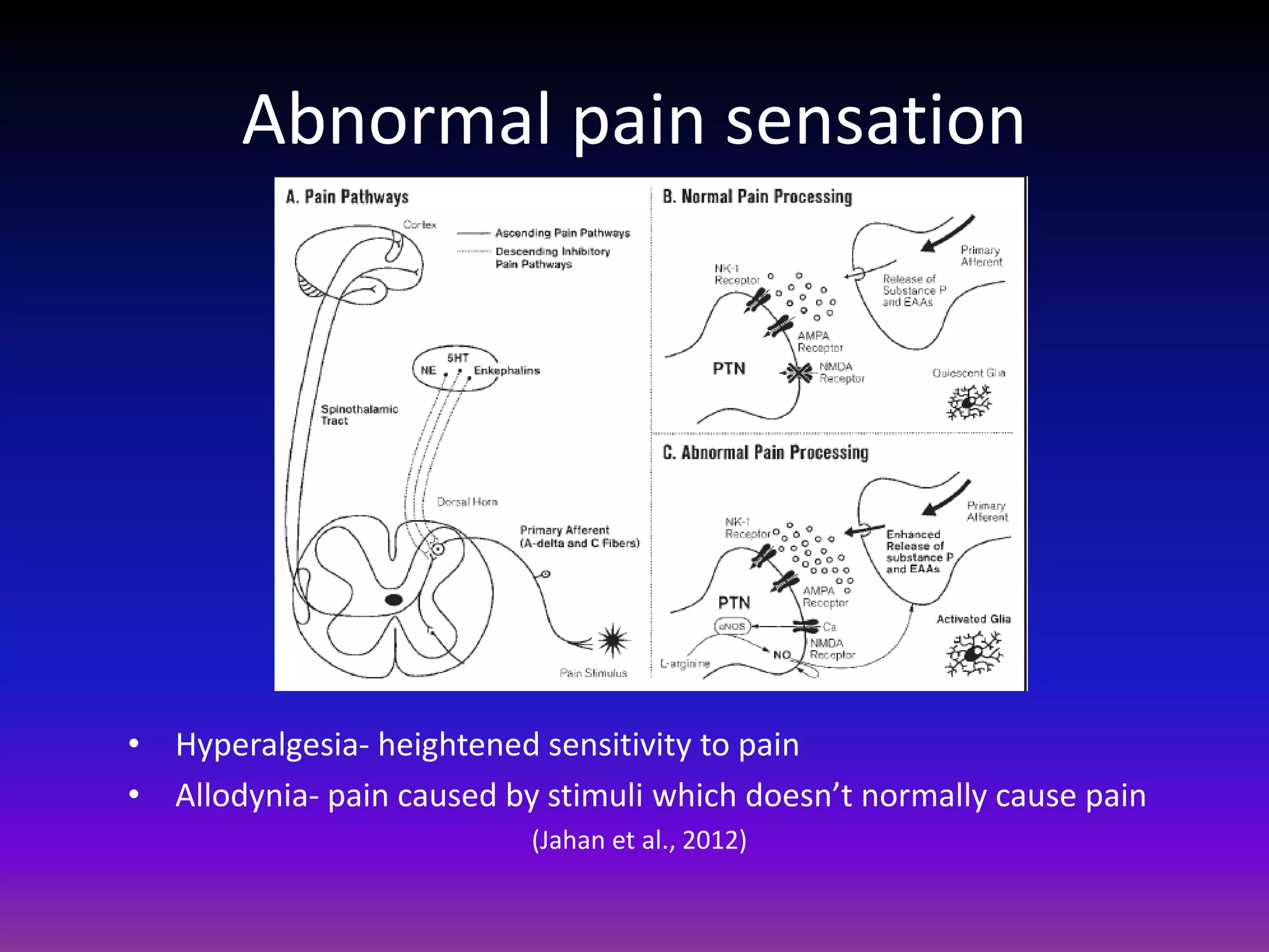 Fibromyalgia powerpoint completed | PPTX