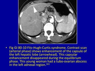 80 perihepatic space | PPT