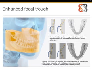 Carestream 81003D CBCT From 360 Dental | PPT