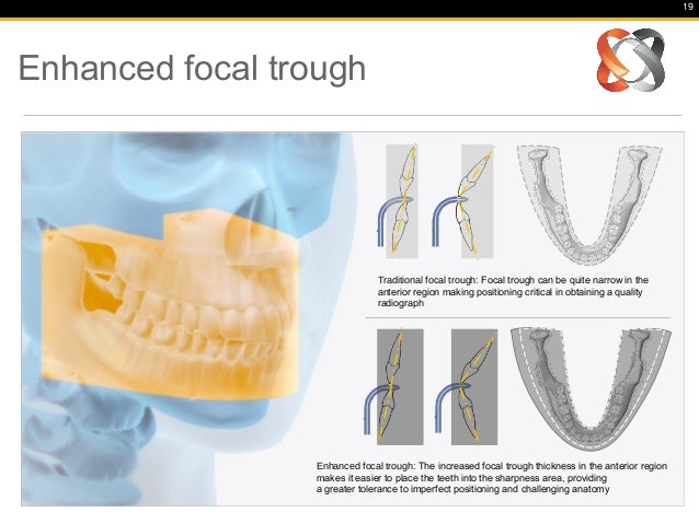 Carestream 81003D CBCT From 360 Dental