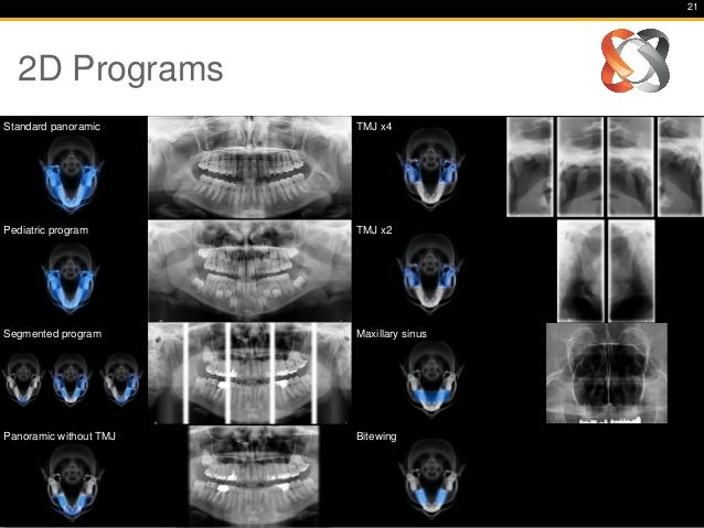 Carestream 81003D CBCT From 360 Dental