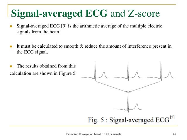 ECG BIOMETRICS