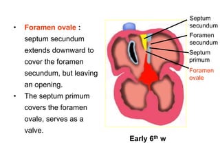 Interventricular Foramen Heart