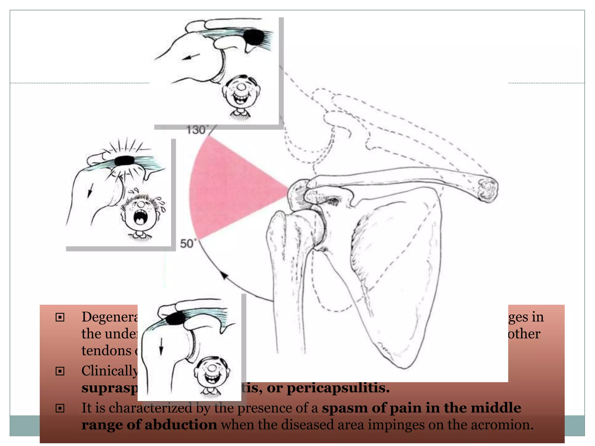 811_Anatomy-of-shoulder-joint.ppt