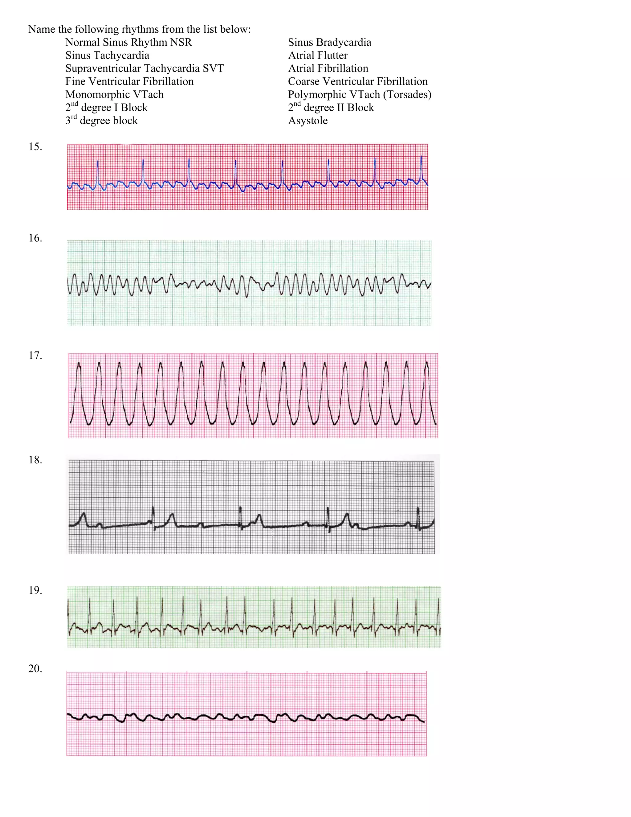 ACLS | PDF