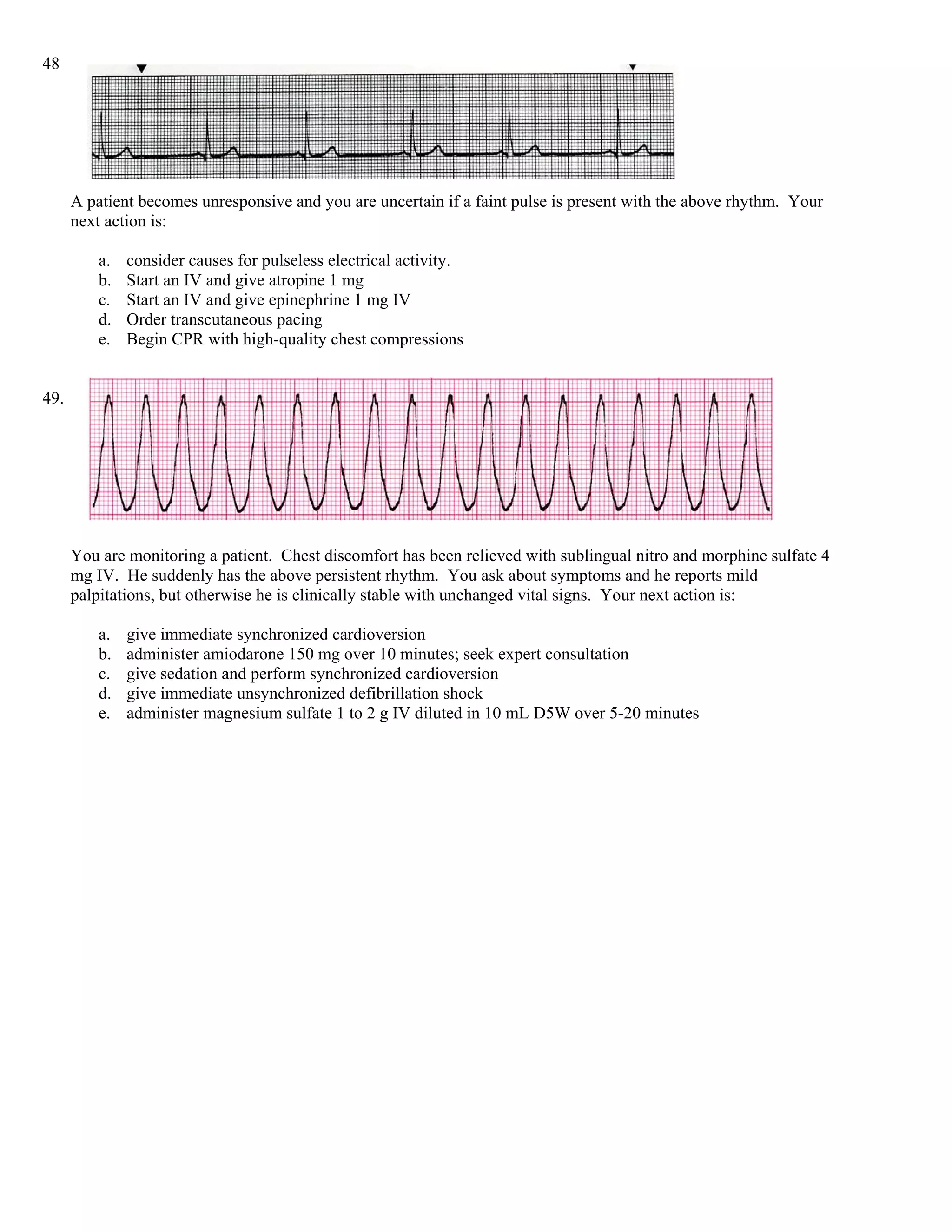 ECG FOR acls | PDF