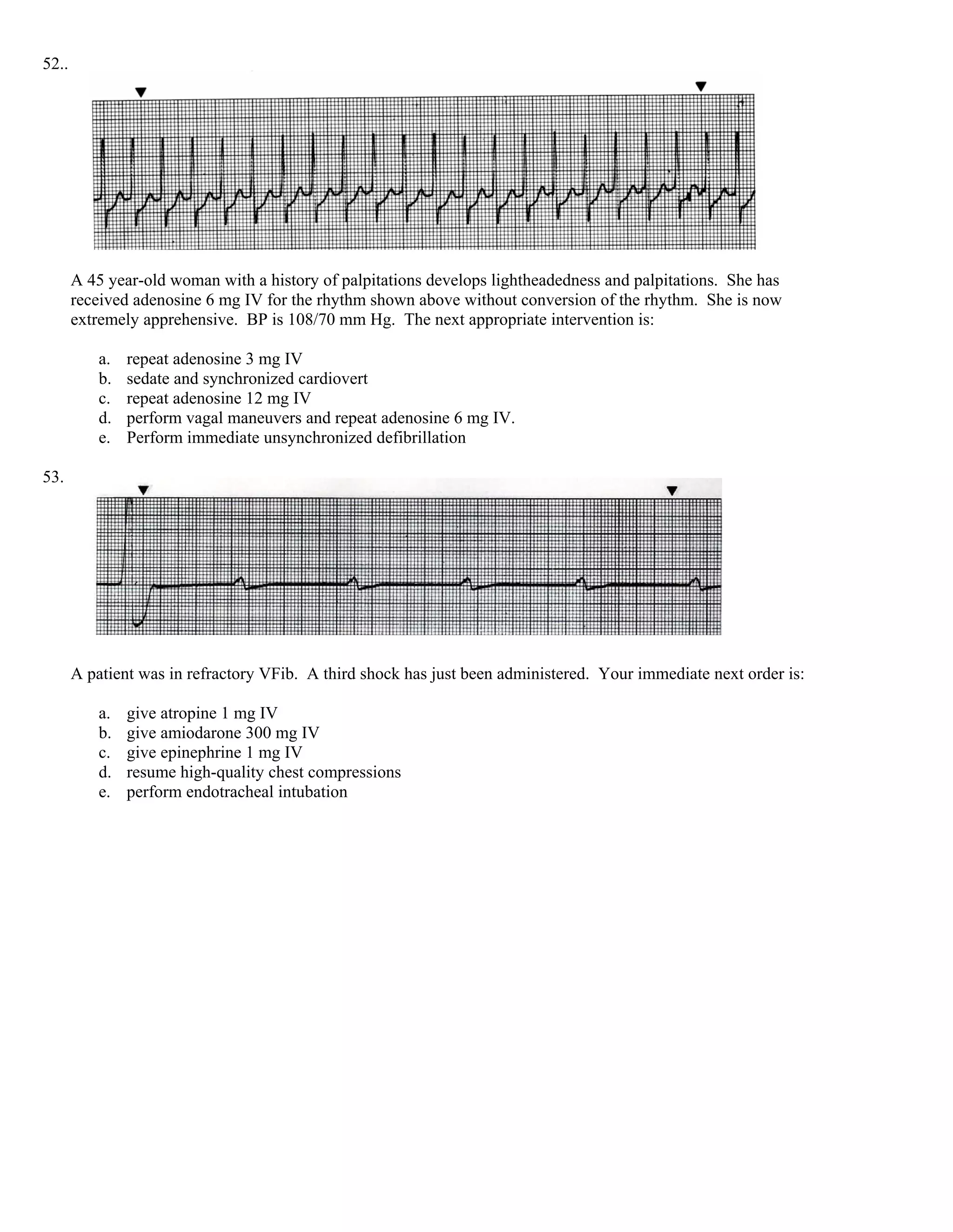 ECG FOR acls | PDF