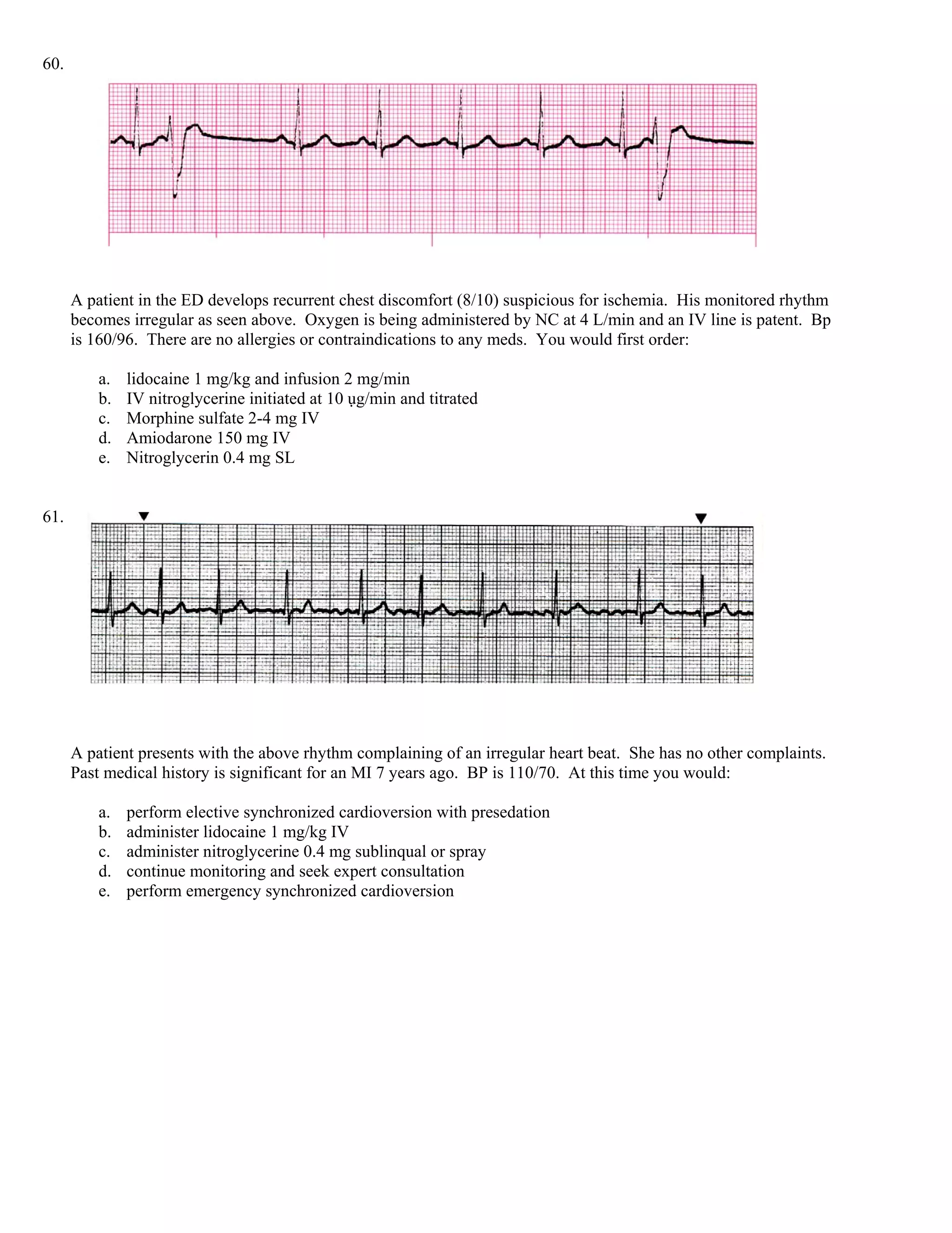 ECG FOR acls | PDF
