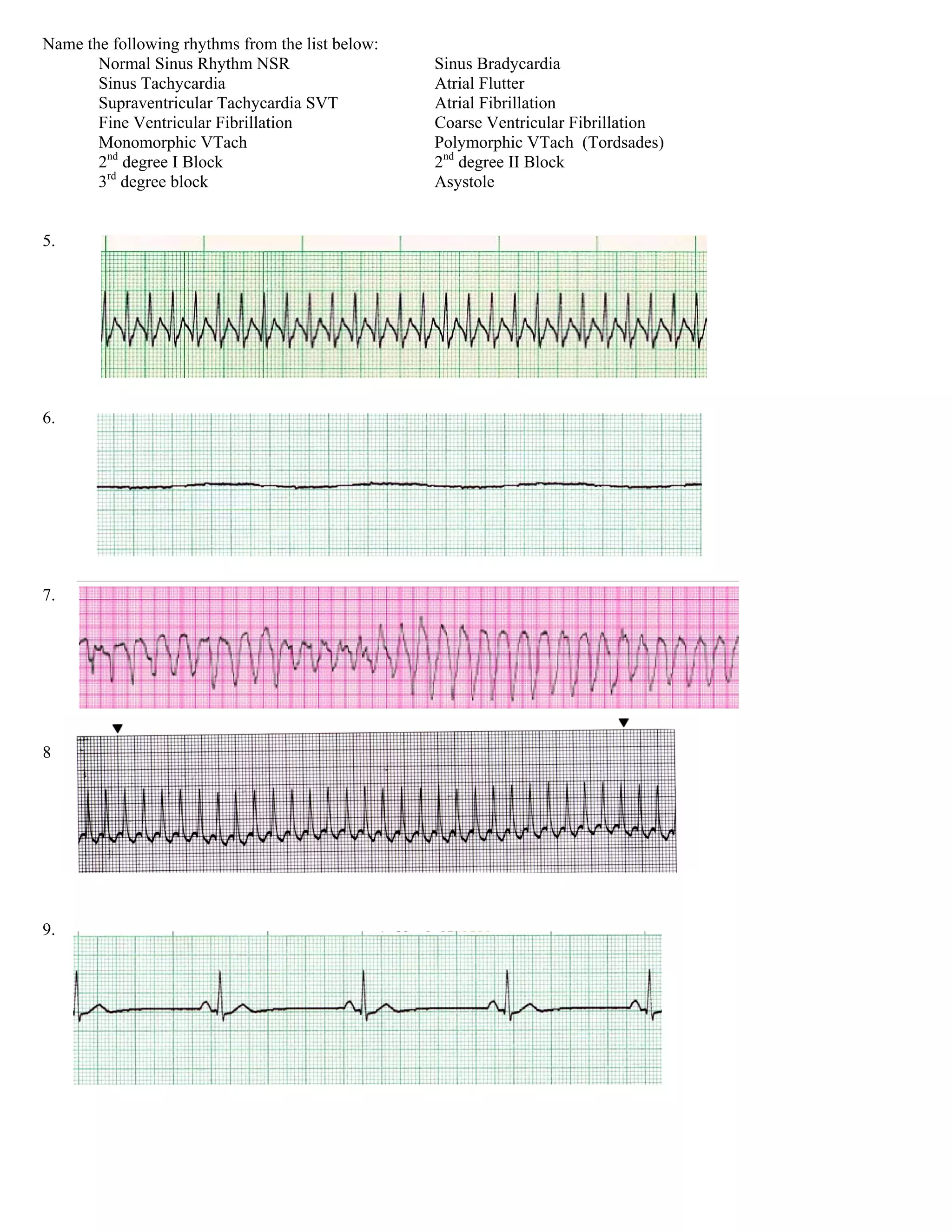 ECG FOR acls | PDF