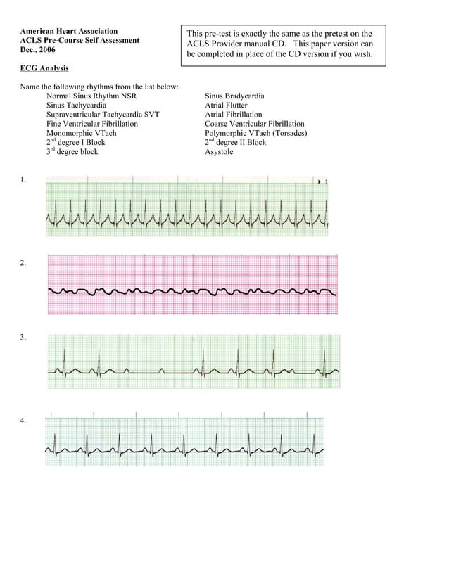 ECG FOR acls | PDF