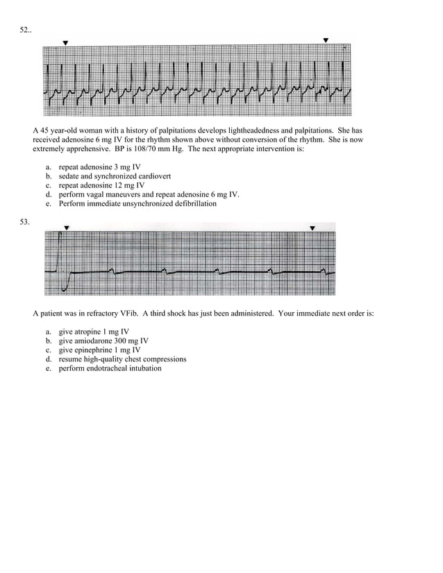 ECG FOR acls | PDF