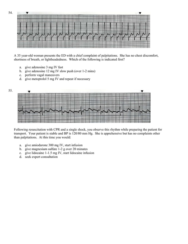 ECG FOR acls | PDF