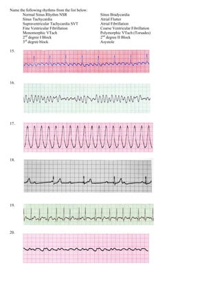 Acls Ecg Rhythm Interpretation Factory Sale | www.jkuat.ac.ke