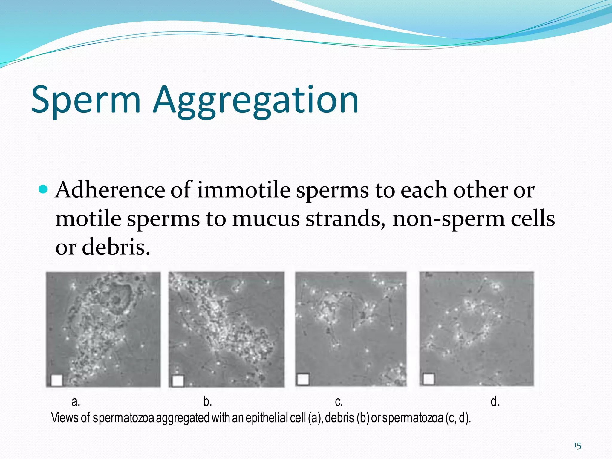 SEMEN ANALYSIS POWERPOINT | PPTX