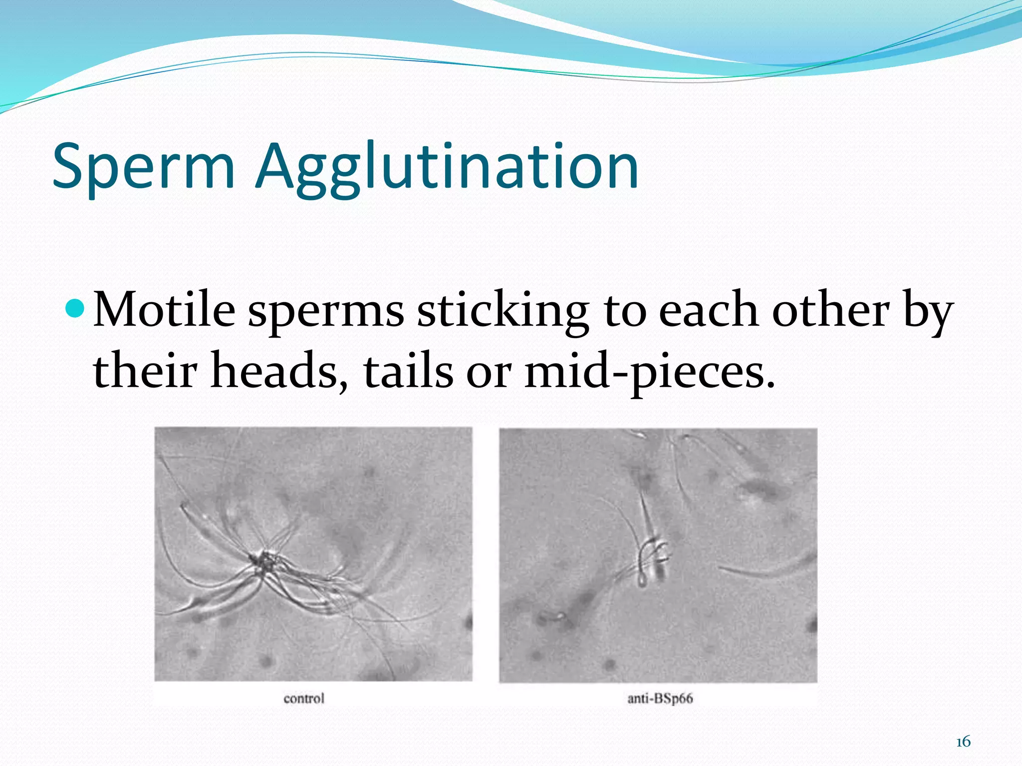 SEMEN ANALYSIS POWERPOINT | PPTX