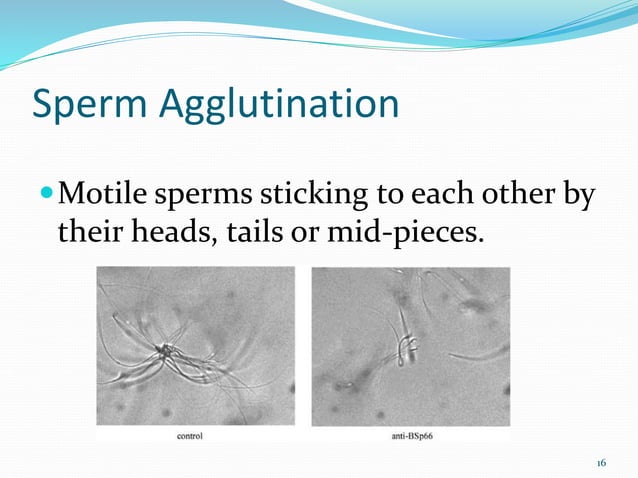 SEMEN ANALYSIS POWERPOINT | PPTX | Infertility | Reproductive Health