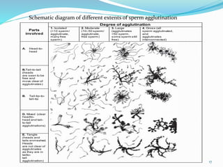 SEMEN ANALYSIS POWERPOINT | PPTX