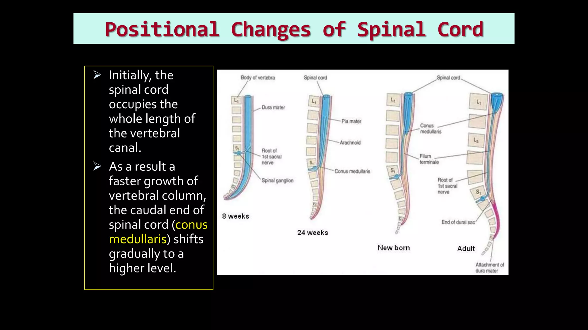 Embryology and Development of Spinal Dysraphism and Tethered Spinal ...