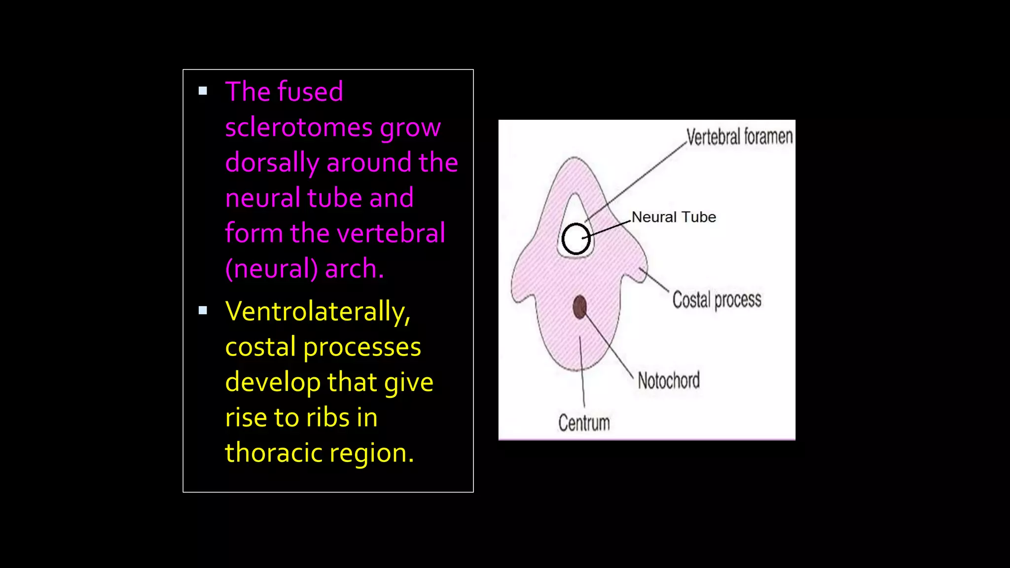 Embryology and Development of Spinal Dysraphism and Tethered Spinal ...