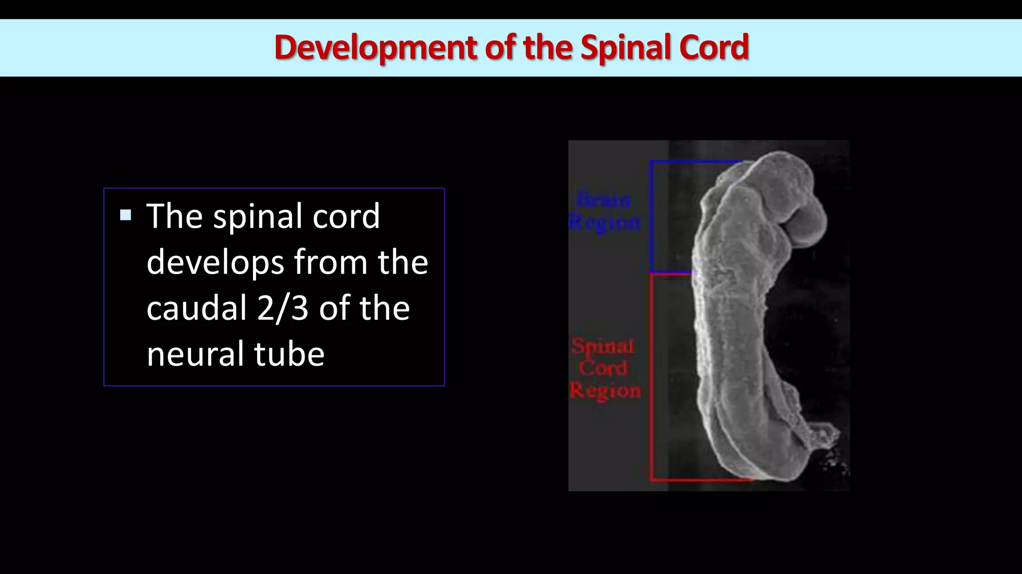 Embryology and Development of Spinal Dysraphism and Tethered Spinal ...