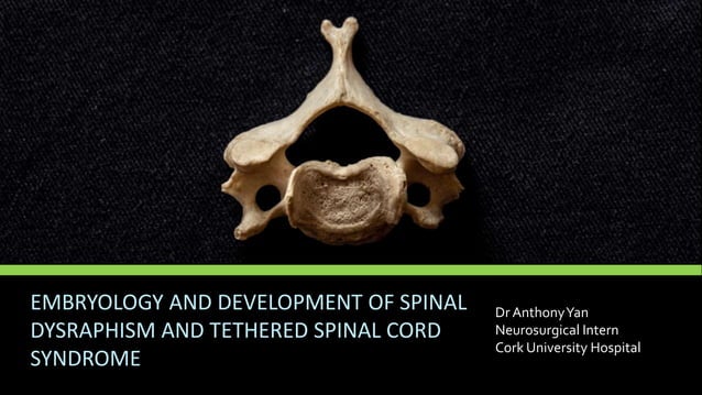 Embryology and Development of Spinal Dysraphism and Tethered Spinal ...