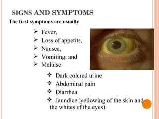 infectious hepatitis | PPT