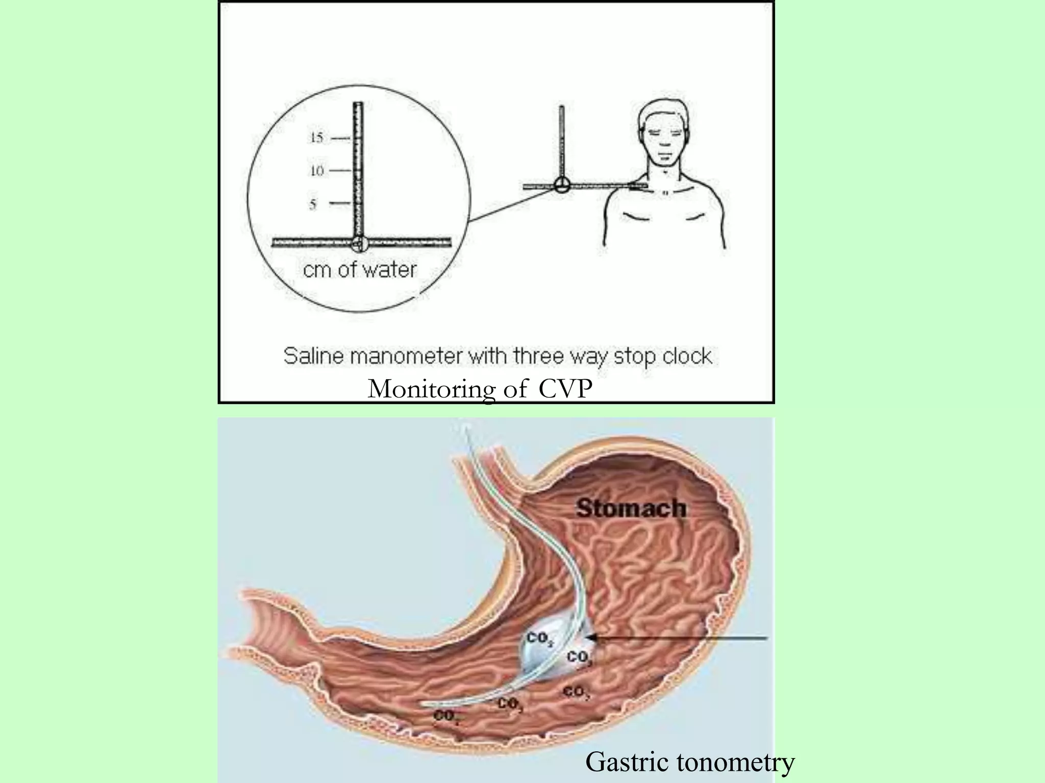 Monitoring Of Critically Ill Patient Ppt