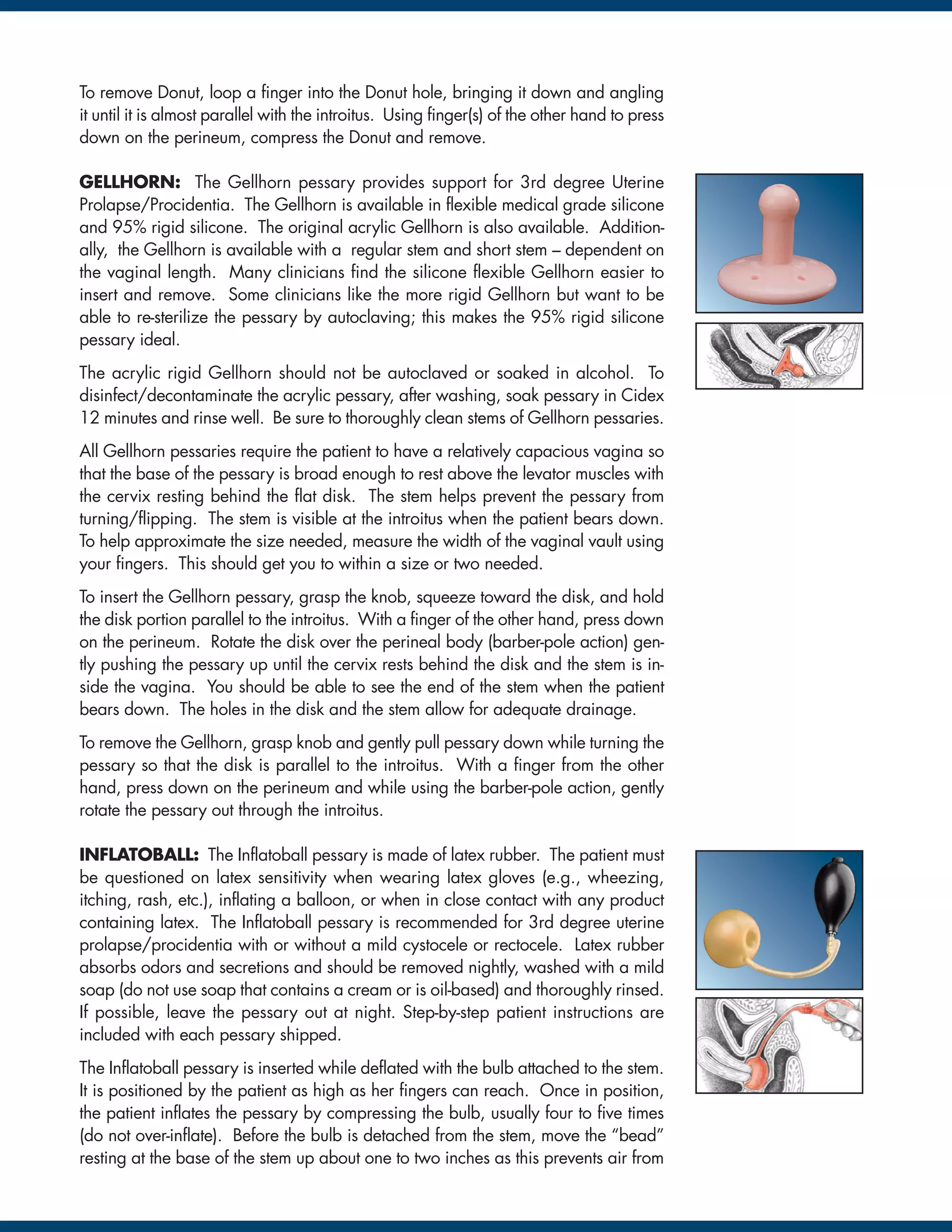 81709 pessaryinservice.qrk layout 1 | PDF
