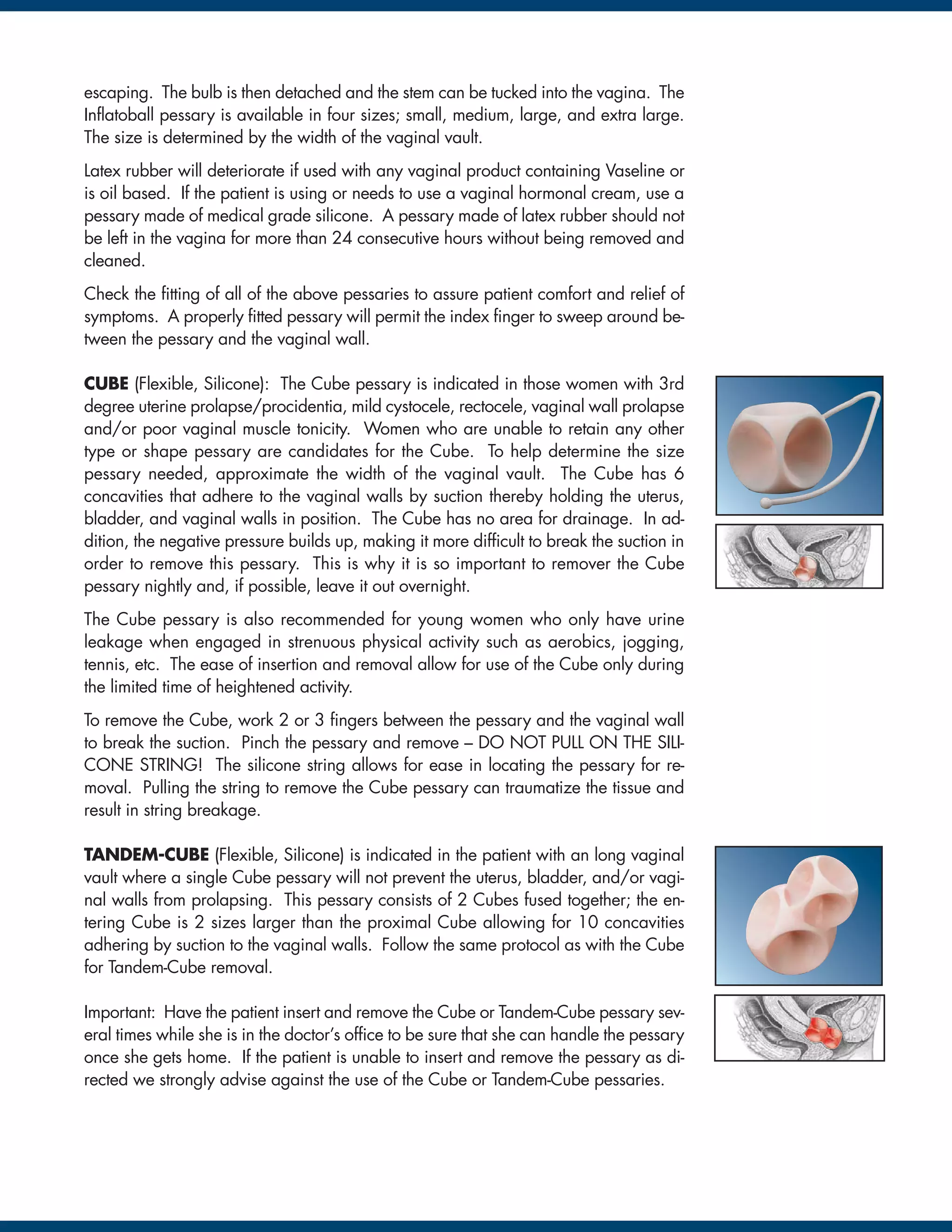 81709 pessaryinservice.qrk layout 1 | PDF