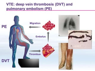 DVT Presentation1 preview | PPT