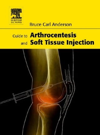 Guide To Arthrocentesis And Soft Tissue Injection Bruce Anderson | PDF