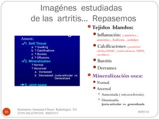 anatomia-radiologica-artritis-clasificacion-parte-i-3 | PPT