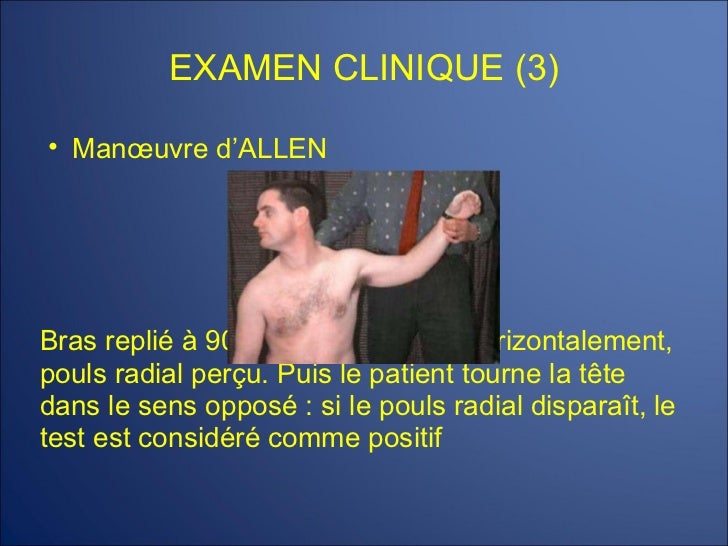 SYNDROMES DE LA TRAVERSEE CERVICO-THORACO-BRACHIALE (STCTB)